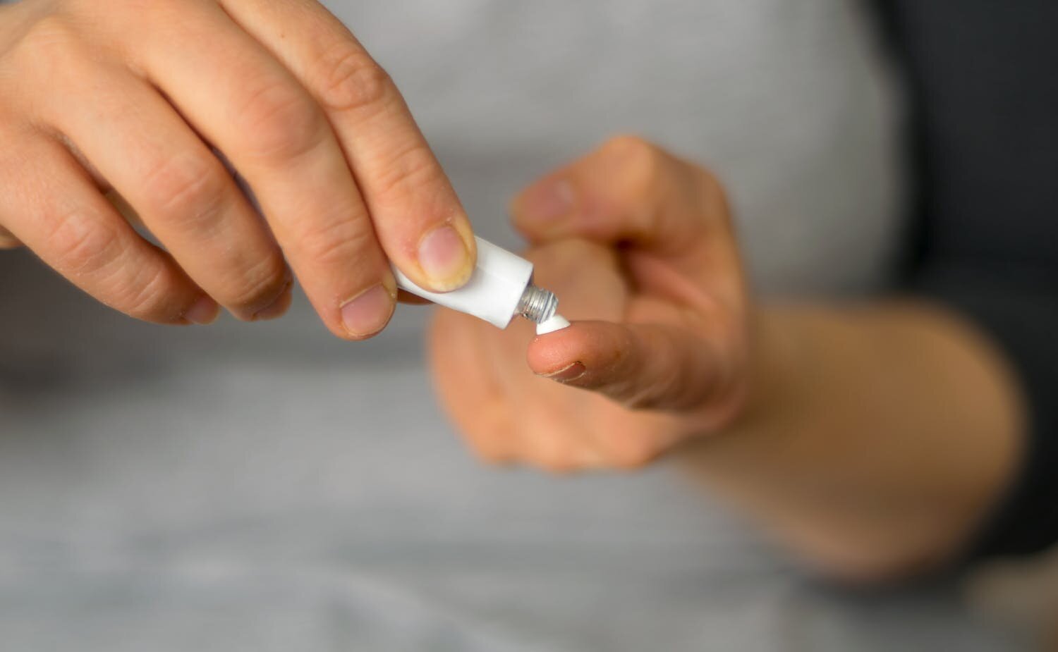 Furoncle: Traitements et conseils pour se soigner seul efficacement ...