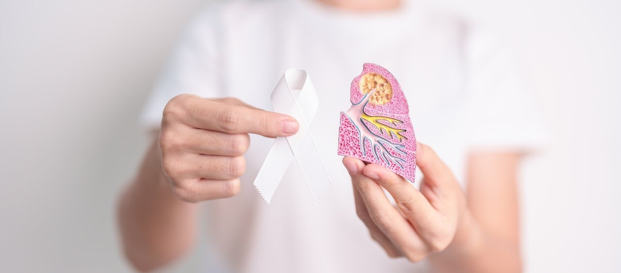 Substance dangereuse multipliant le risque de cancer du poumon - One Media