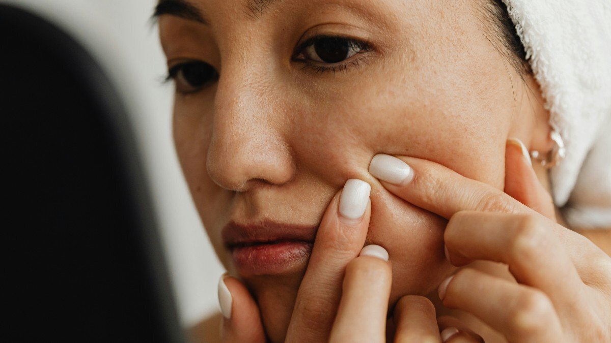 Les dangers de percer un bouton dans le triangle de la mort - One Media